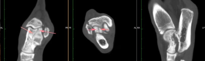 Dechra previews DuOtic otic gel for otitis externa at LVS