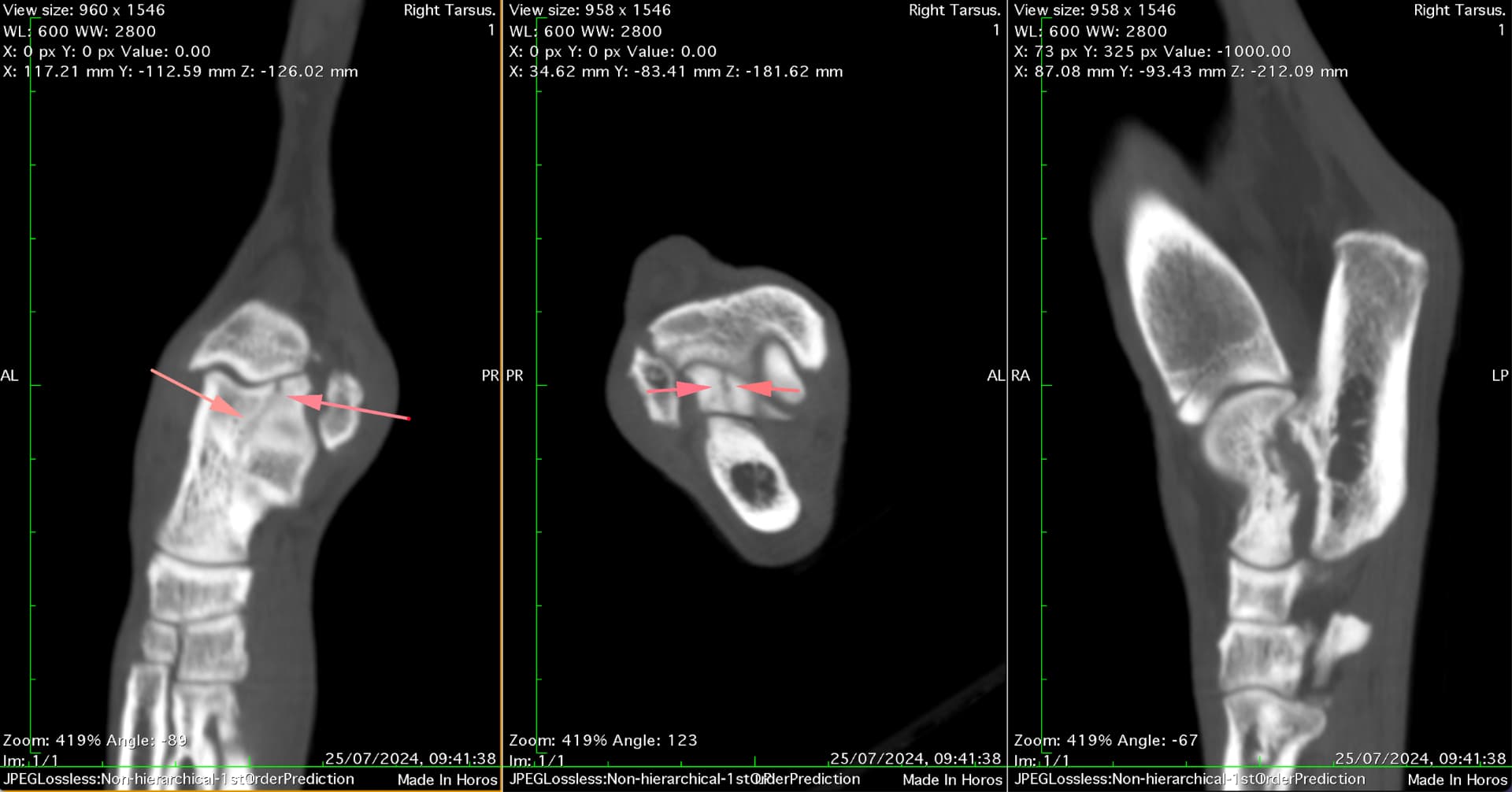 East of England Specialists resolve challenging canine tarsus fracture