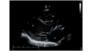 Cardiopatia congénita felina: compreender os sinais clínicos e gerir os ...
