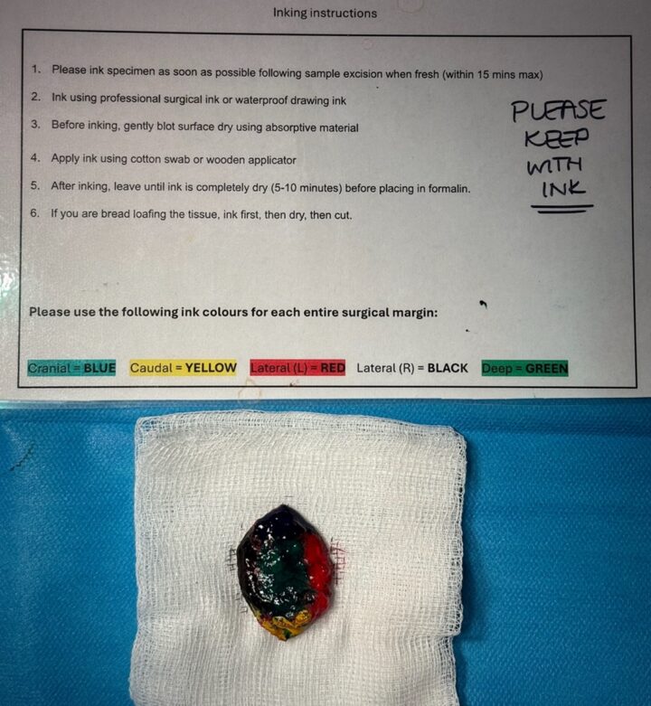 Surgical approach to cutaneous and subcutaneous masses: staging and ...