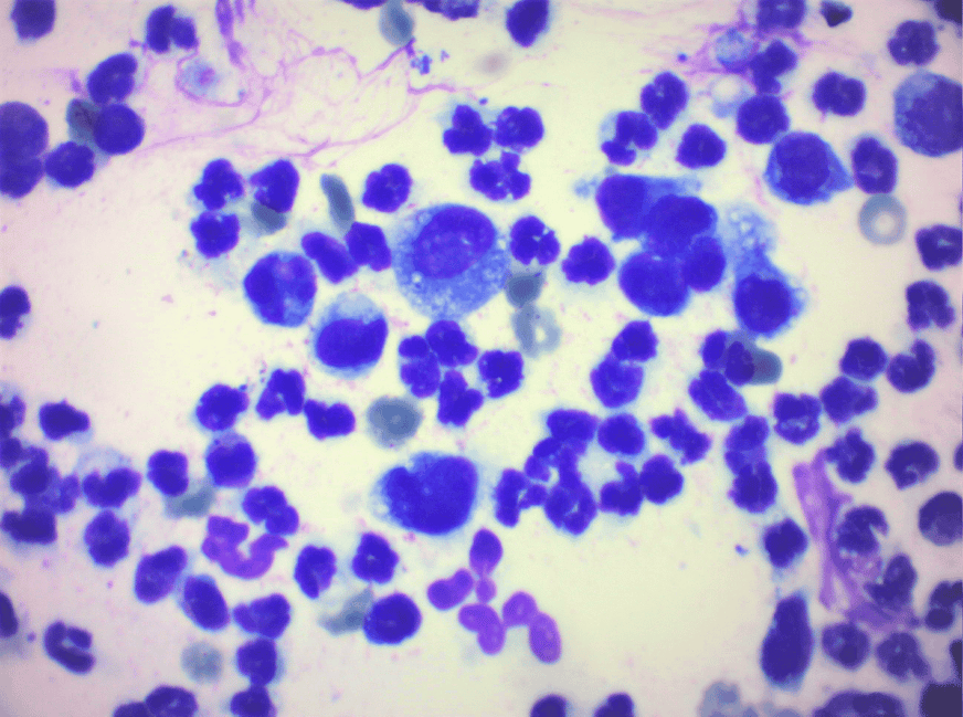 Sterile pyogranulomatous/granulomatous dermatitis (aka puppy strangles)