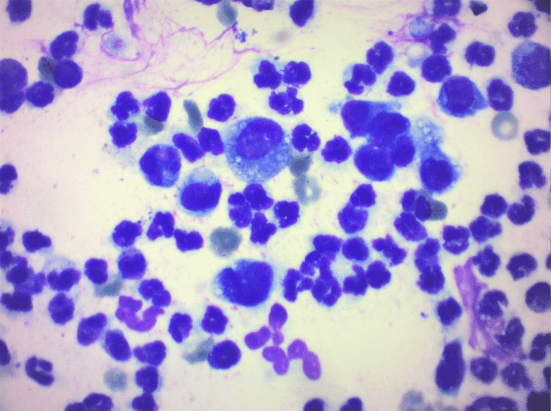 Sterile pyogranulomatous/granulomatous dermatitis (aka puppy strangles)