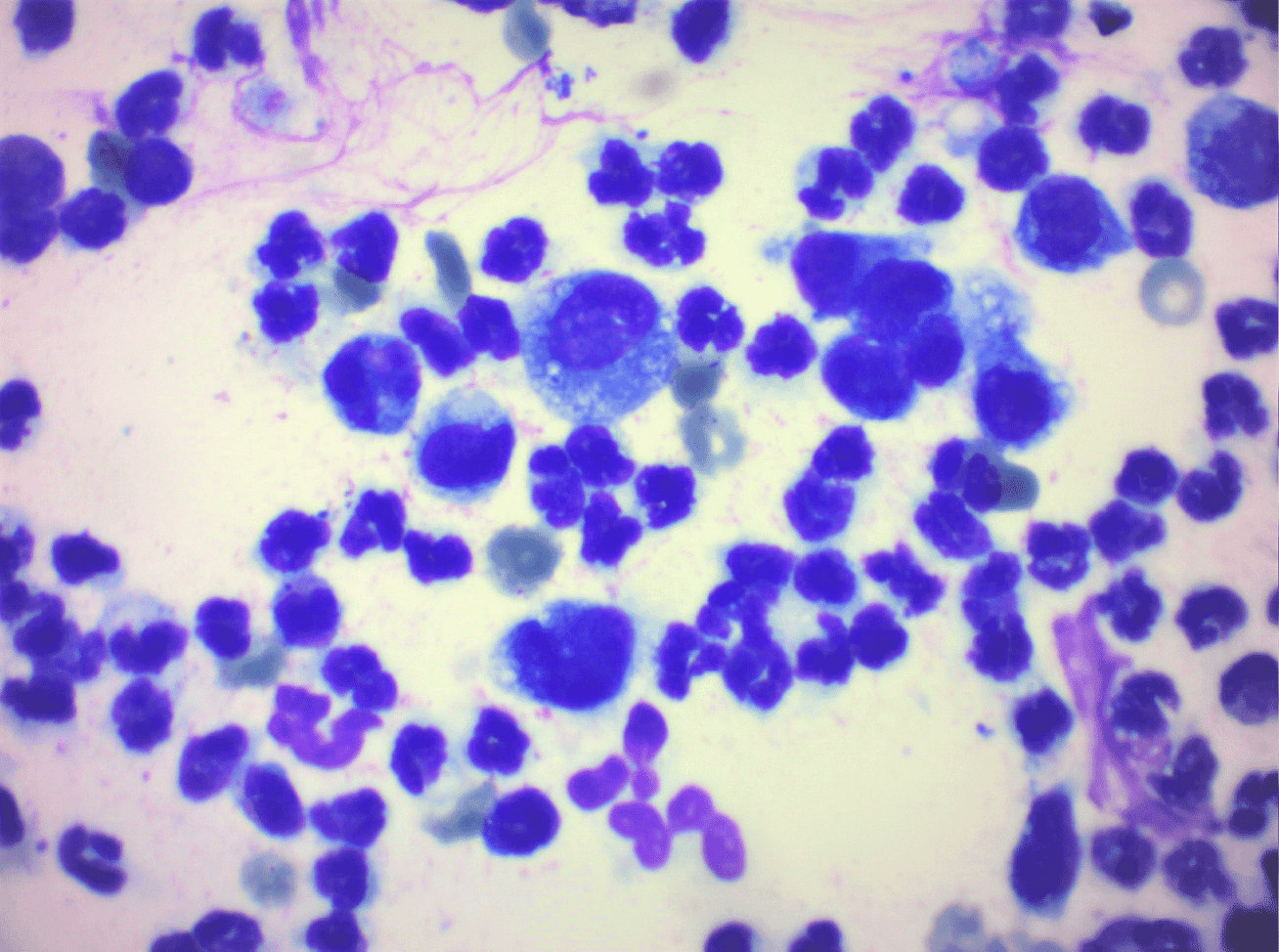 Sterile pyogranulomatous/granulomatous dermatitis (aka puppy strangles)