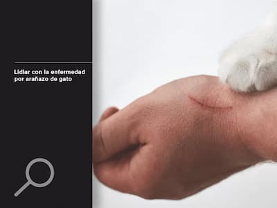 Lidiar con la enfermedad por arañazo de gato